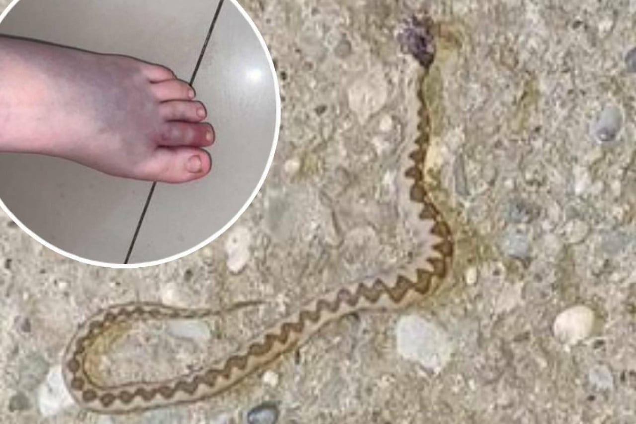 Slobodna Dalmacija - Poskok ugrizao djevojčicu, objavljena fotografija ...